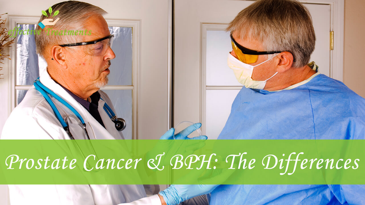 Benign Prostatic Hyperplasia (BPH): What Is CRUCIAL To Know