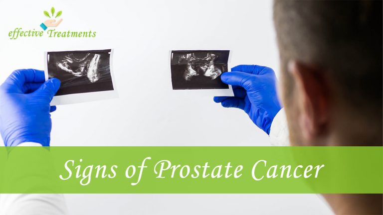 The ACTUAL Signs of Prostate Cancer You Need To Know