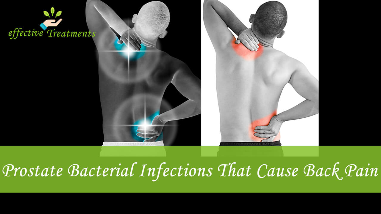 Prostate Infections And Back Pain [The Relation And Cures]