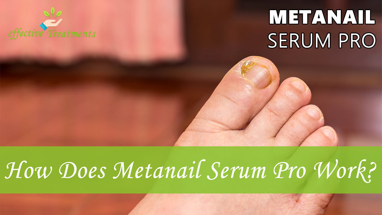 Metanail Serum Pro Review [Michael Forrester - The Truth]