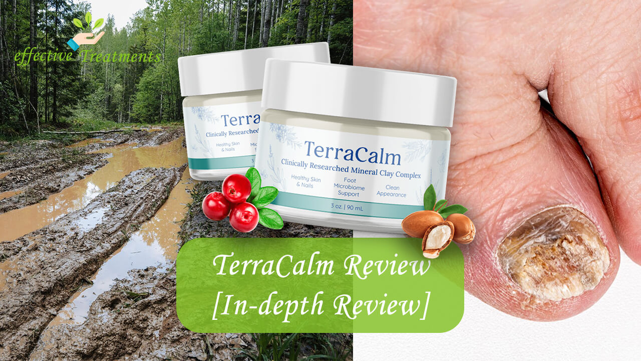 TerraCalm Review [Sean Brown -Antifungal Mineral Clay Truth]